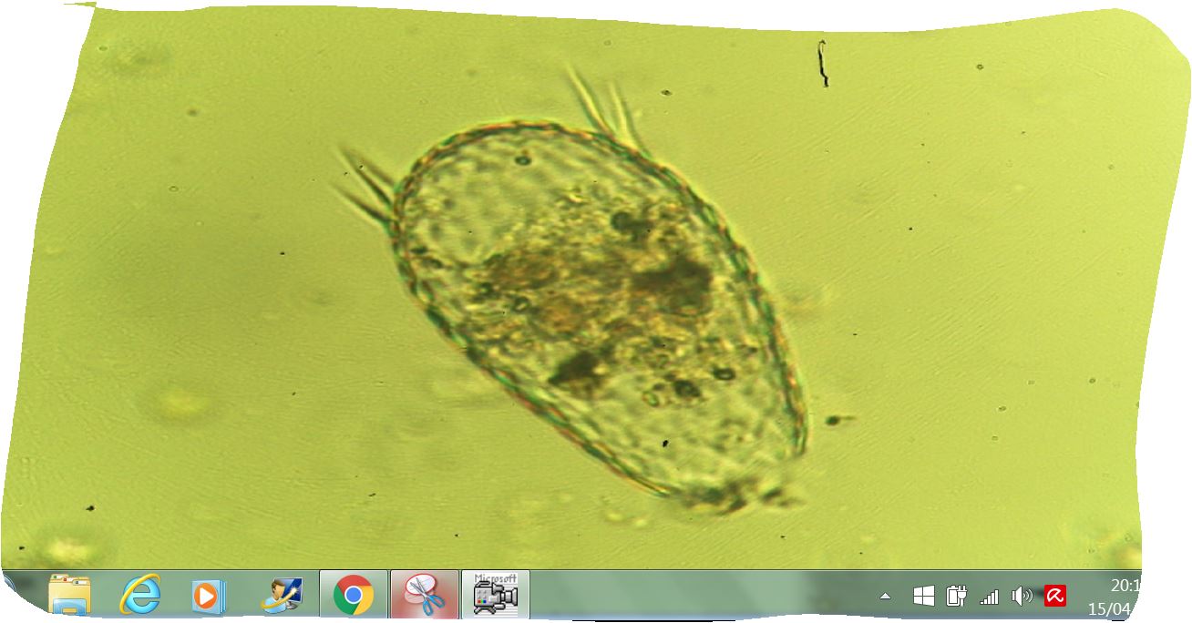 Polyarthra sp , Natura Mediterraneo | Forum Naturalistico