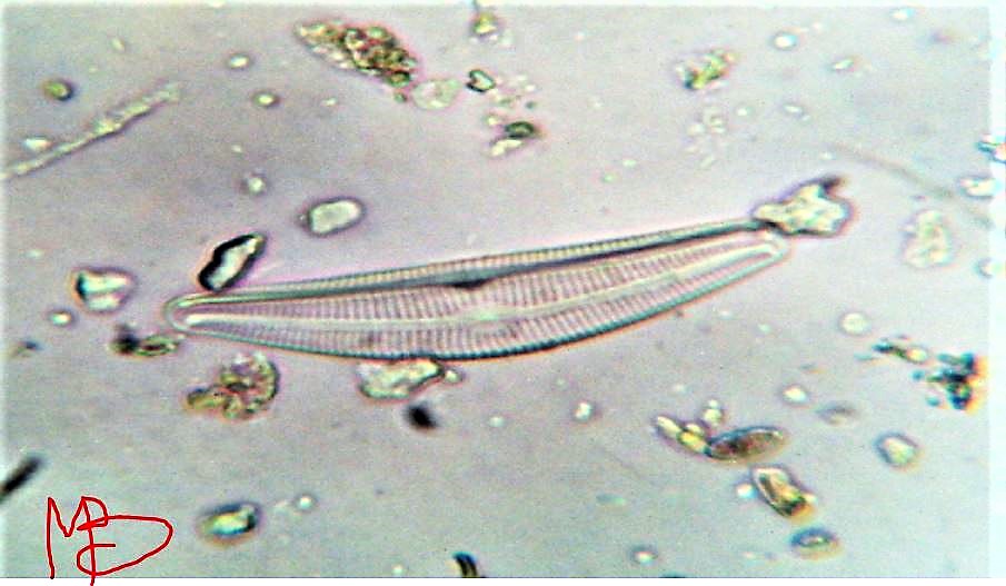 Diatomea Amphora ovalis? conferma grazie , Natura Mediterraneo | Forum ...