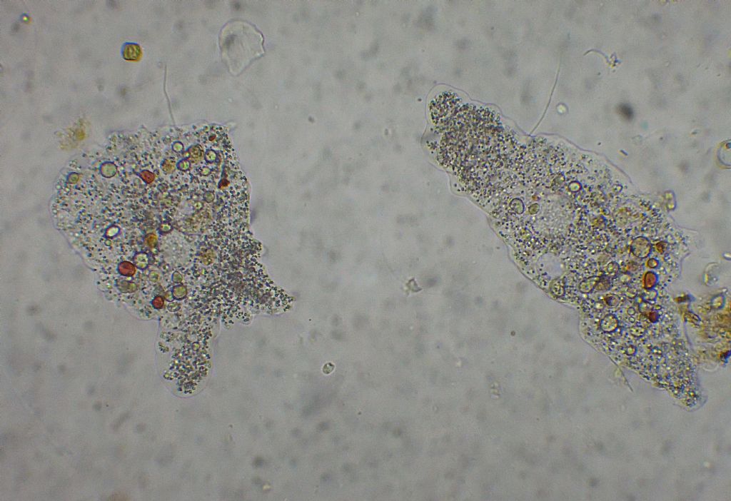 Amebe sp. , Natura Mediterraneo | Forum Naturalistico