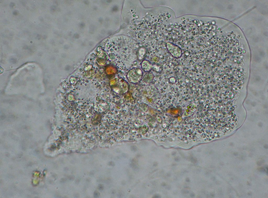 Amebe sp. , Natura Mediterraneo | Forum Naturalistico