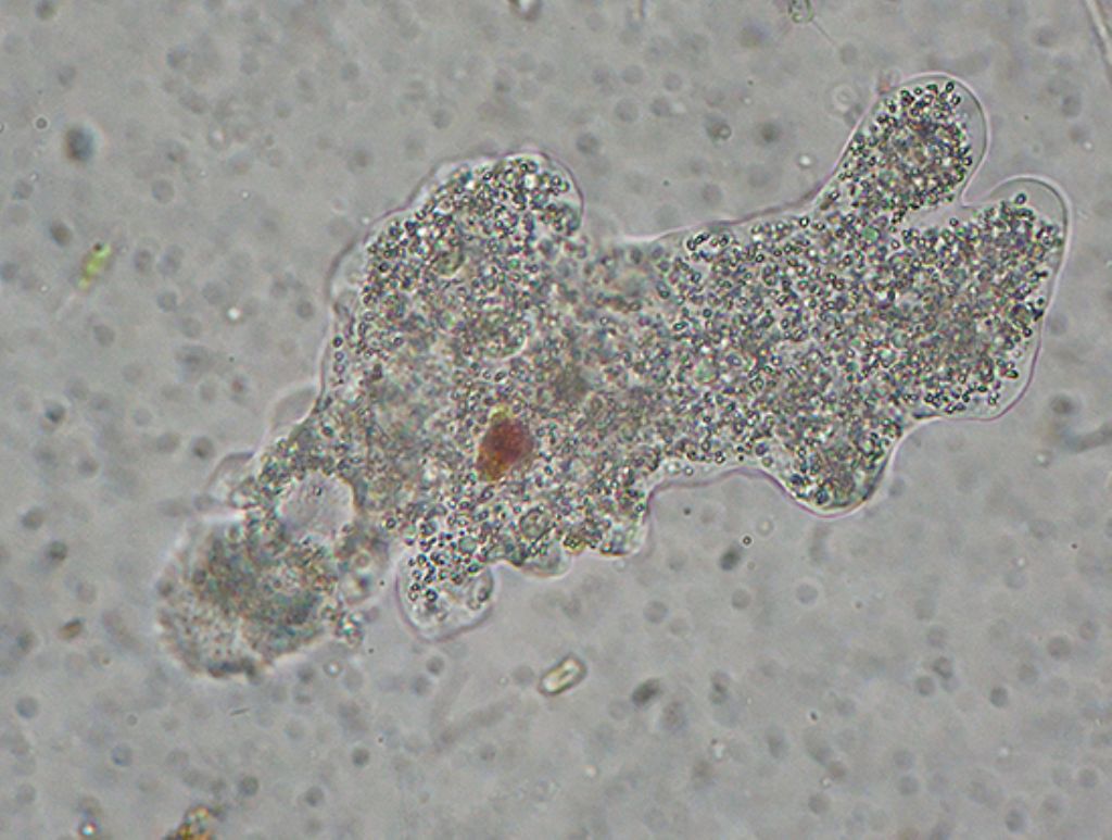 Amebe sp. , Natura Mediterraneo | Forum Naturalistico