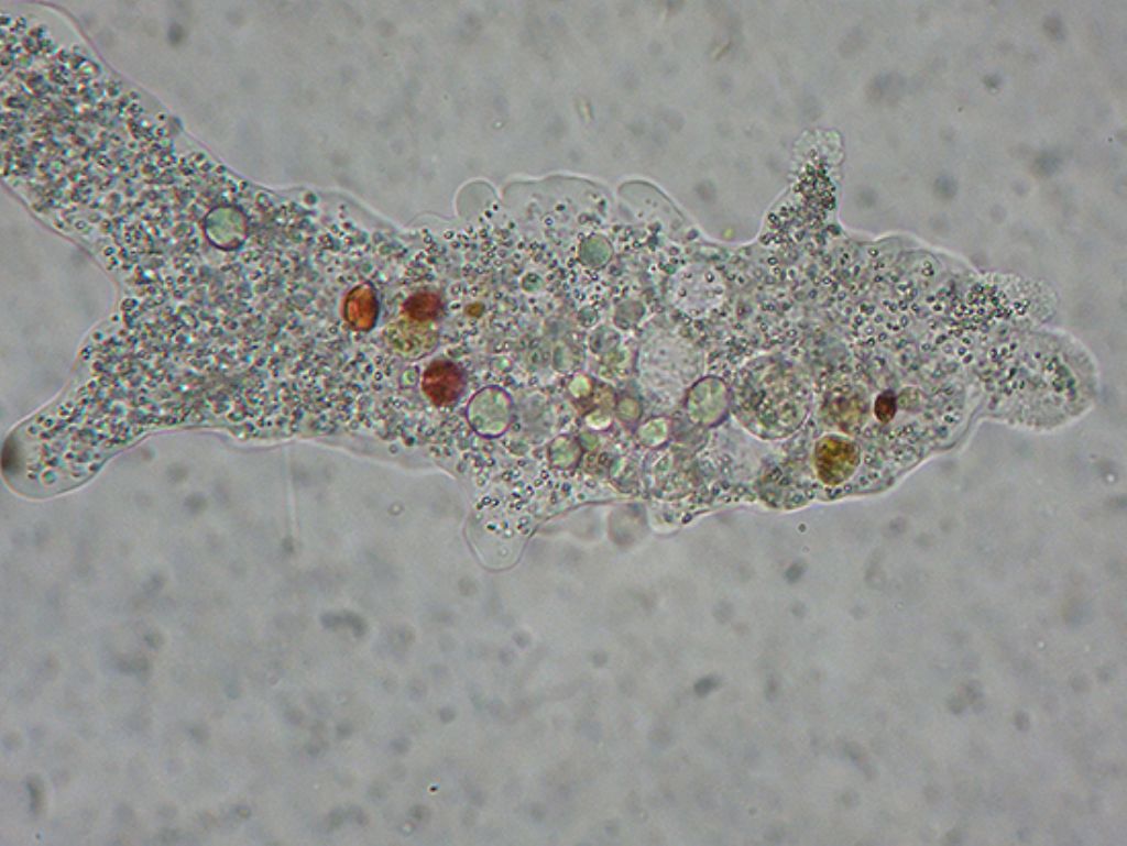 Amebe sp. , Natura Mediterraneo | Forum Naturalistico