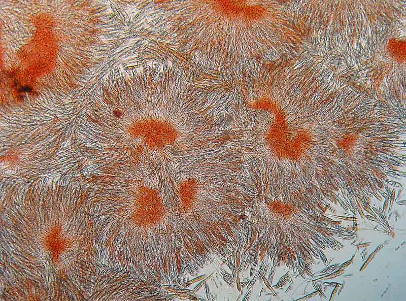 Hypoderma rubi? , Natura Mediterraneo | Forum Naturalistico